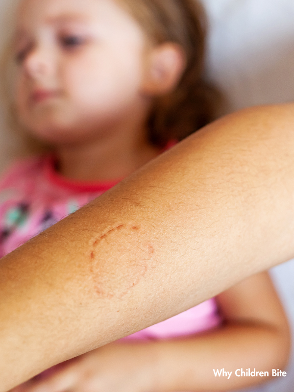Why Children Bite Other Children